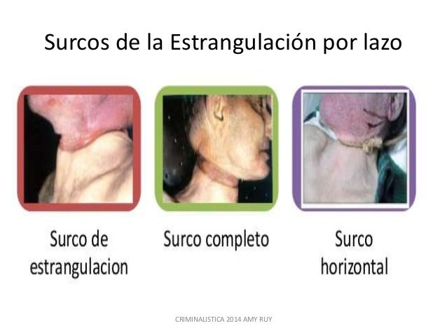 Muertes violentas por estrangulación