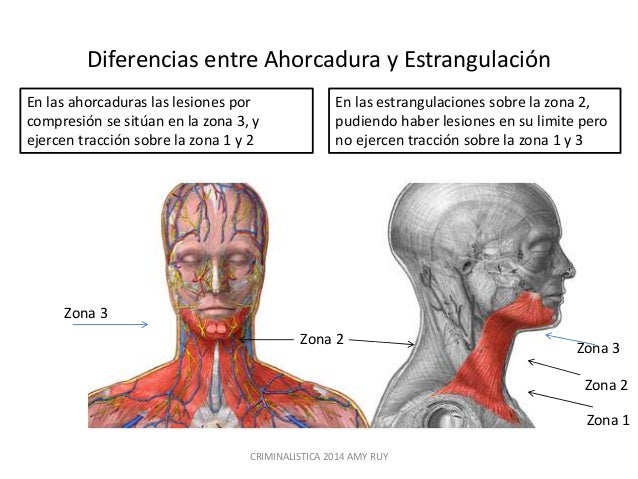 Muertes violentas por estrangulación