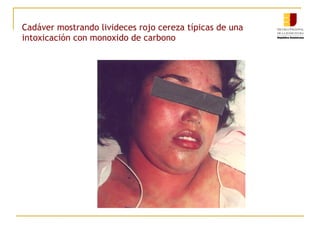 ENJ-300: Muerte y Cambios Post-mortem | PPT