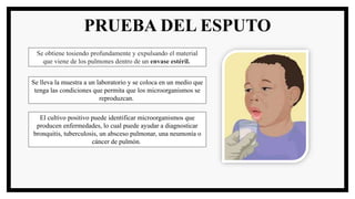 MUESTRA BIOLOGICA ESPUTO.pptx