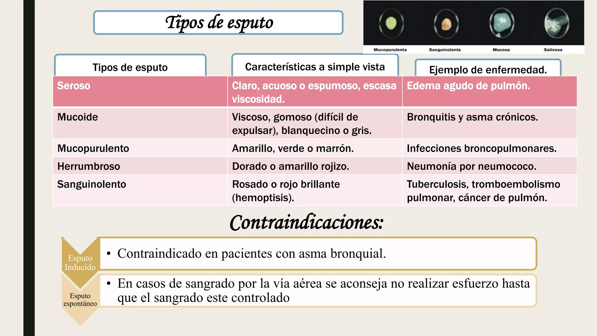 Muestra de esputo | PPTX