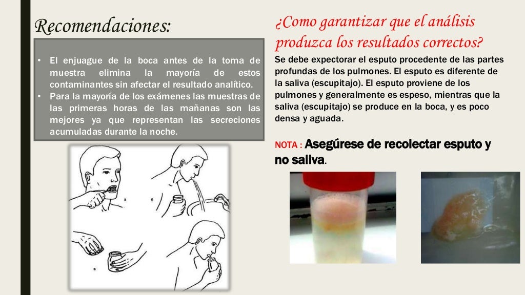 Muestra de esputo