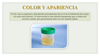 MUESTRAS BIOLÓGICAS ORINA.pptx