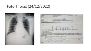 Muh. Amin(1).pptx | Free Download