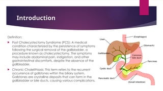 Cholelithiasis .....jjjjhyuggeyhpptx.pptx