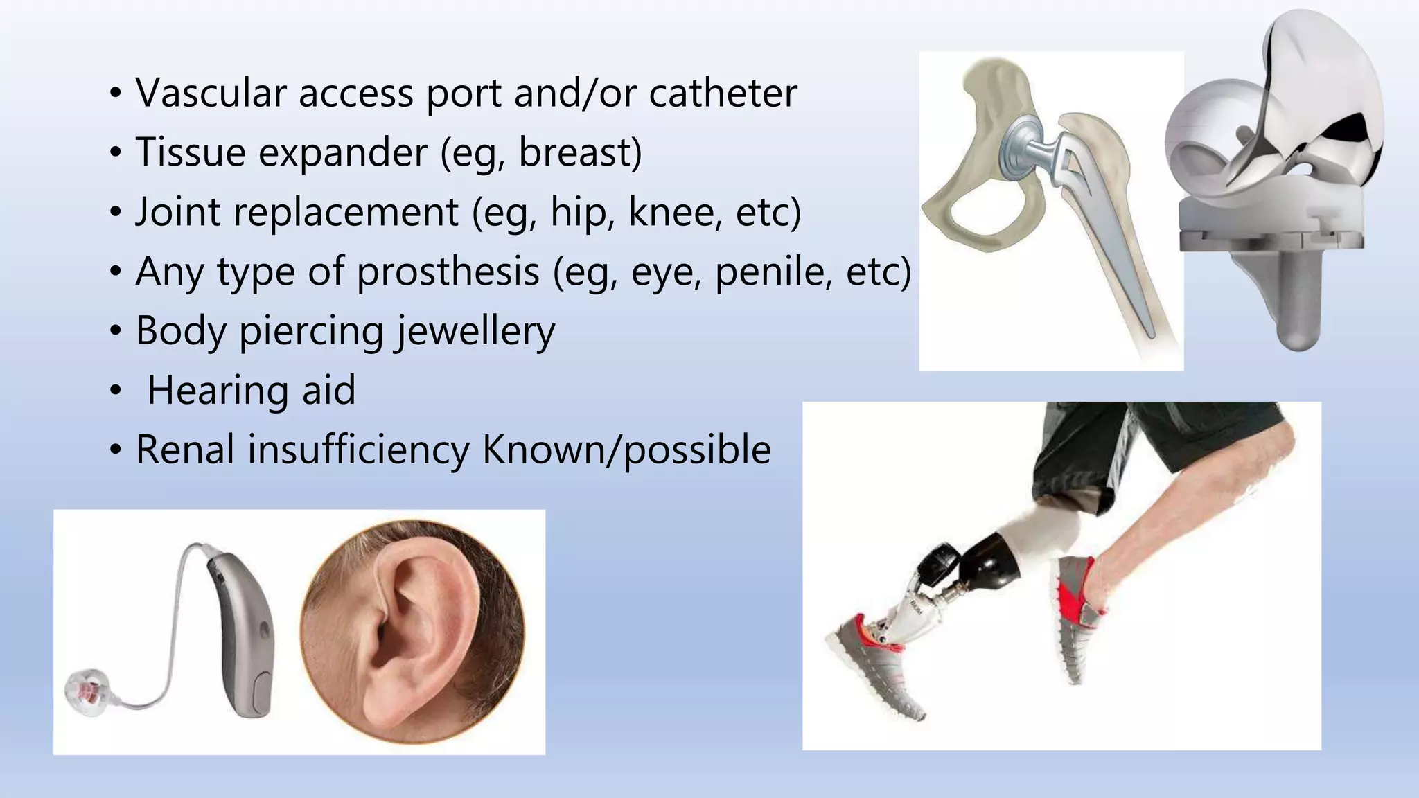 Contraindications to MRI | PPTX