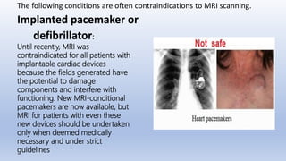 Contraindications to MRI | PPTX