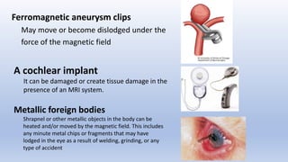 Contraindications to MRI | PPTX