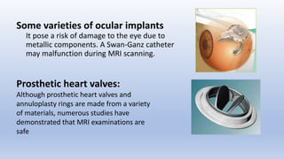 Contraindications to MRI | PPTX