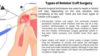 Mukesh Ishwar Suryawanshi - What is Rotator Cuff Surgery.pdf