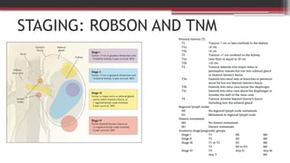 Case presentation of Achondroplasia and renal cell carcinoma | PPT