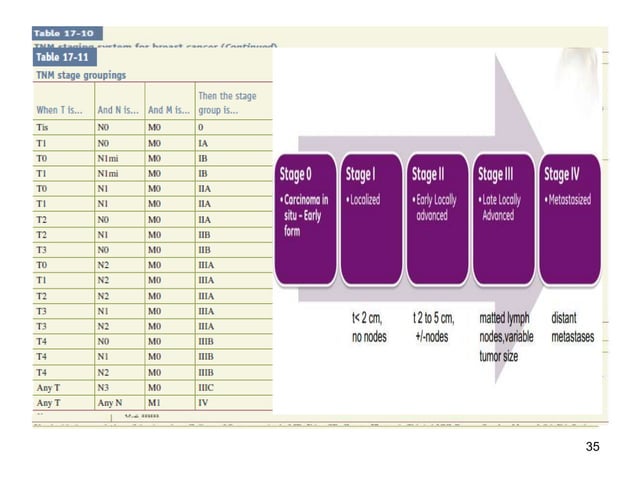 muktar Management of Breast cancer (2).ppt muktar Management of Breast cancer (2).ppt