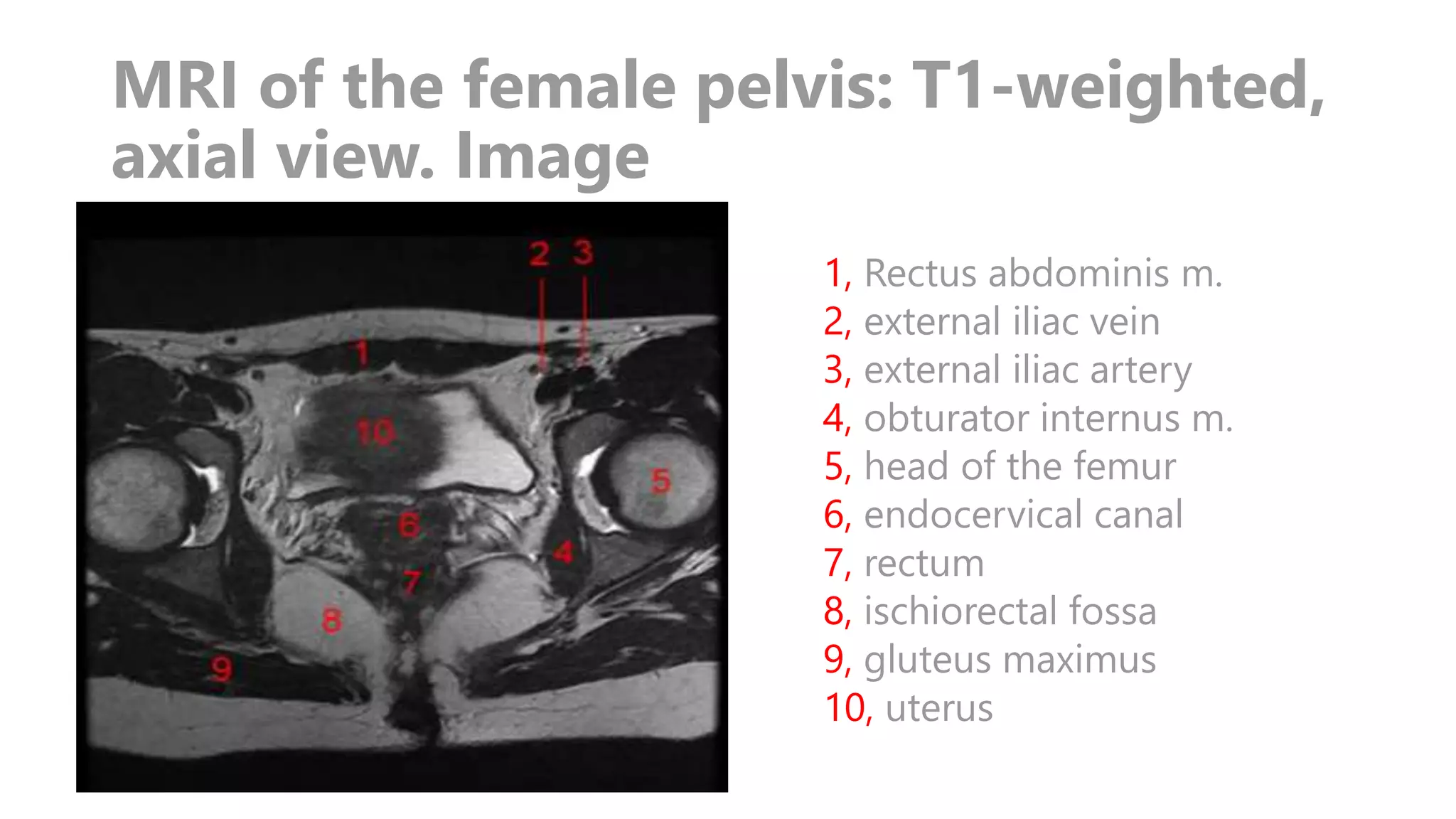 IMAGING & ITS ROLE IN FEMALE GENITAL CANCER | PPTX