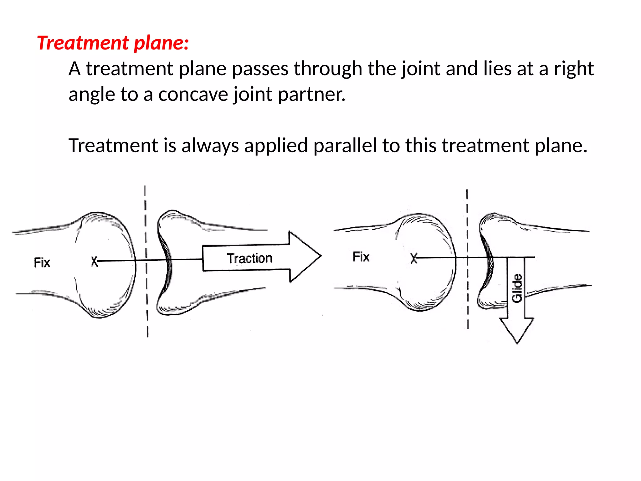 Mulligan mobilization (MWM) | PDF
