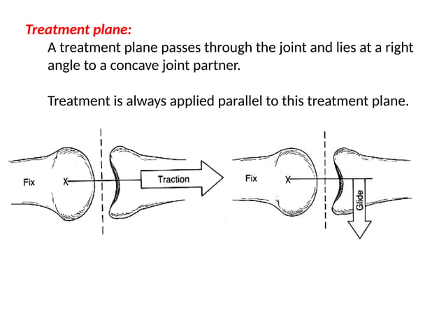 Mulligan mobilization (MWM) | PDF | Physical Therapy | Wellness