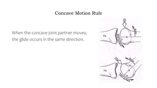 MULLIGAN TECHINIQUE.pptx