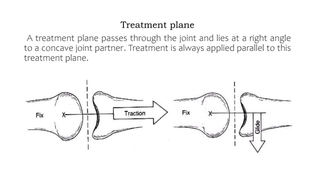 MULLIGAN TECHINIQUE.pptx | Physical Therapy | Wellness