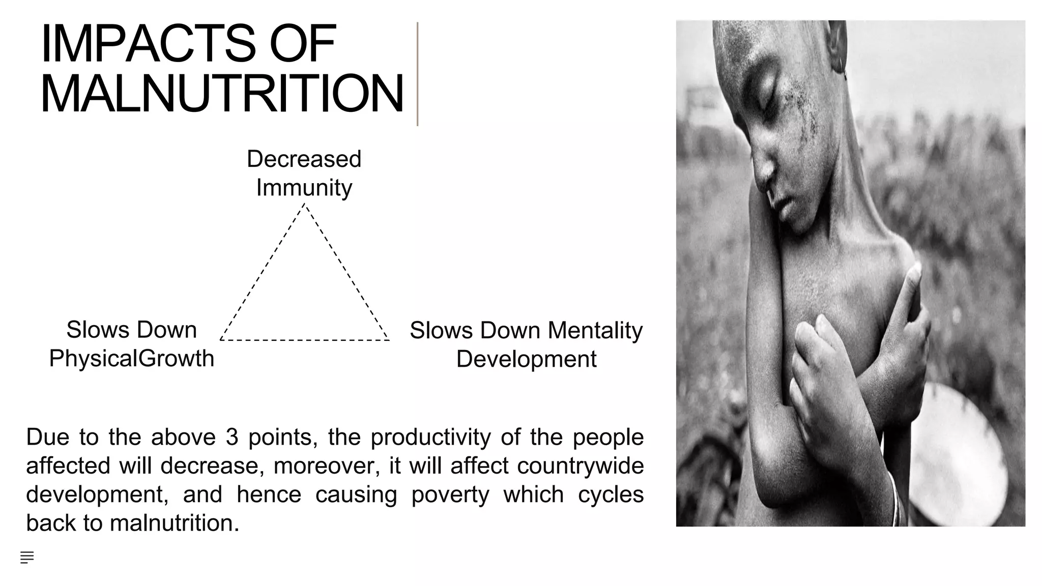 Malnutrition and Hunger | PPTX
