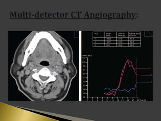 Multi detector ct cerebral angiography | PPTX
