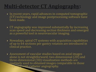 Multi detector ct cerebral angiography | PPT