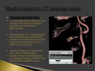 Multi detector ct cerebral angiography | PPTX