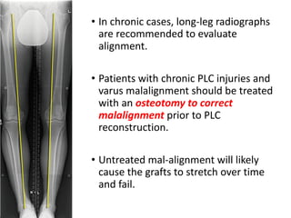Multi ligamentous knee injury | PDF