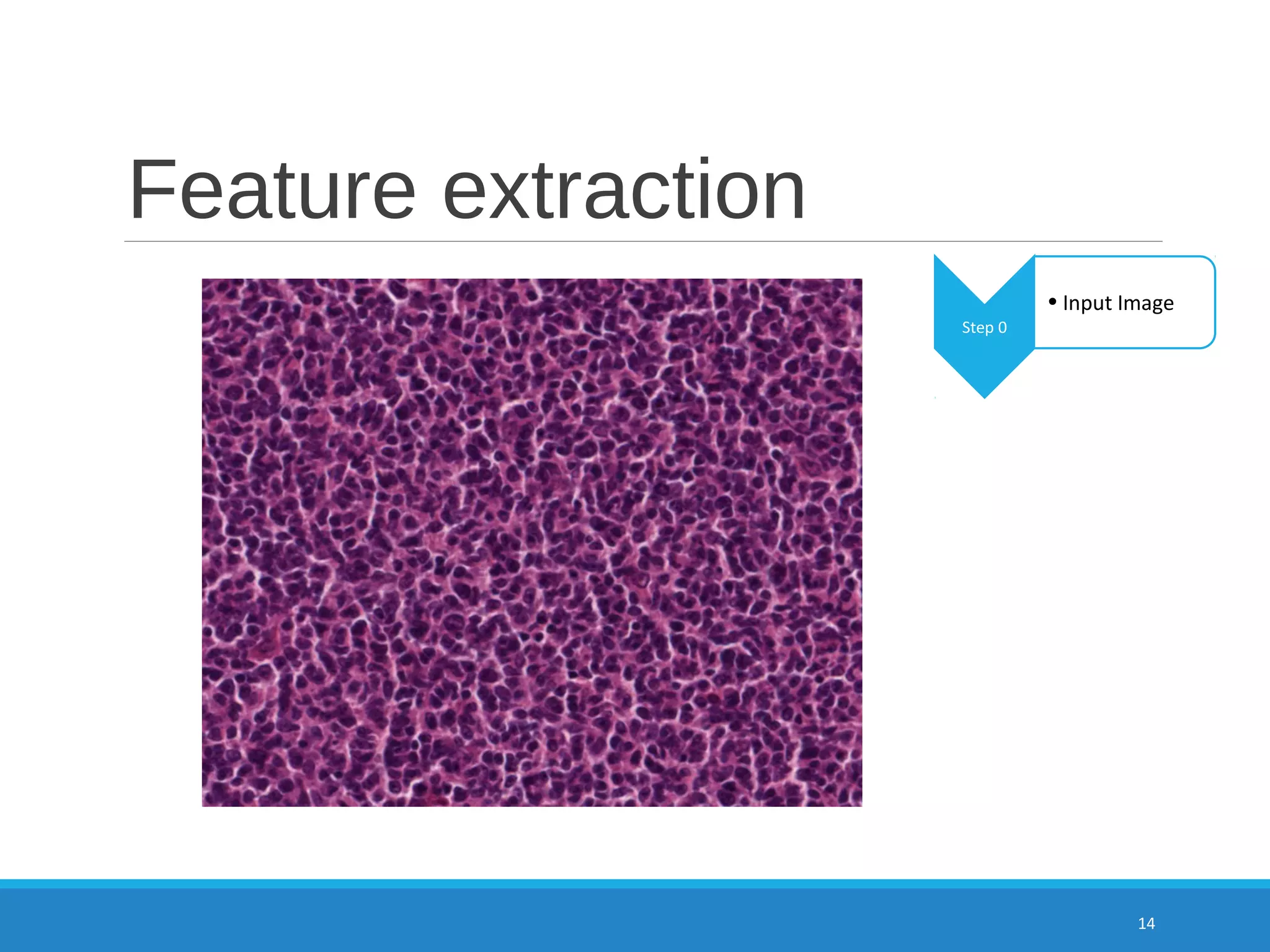 Multi Scale Directional Filtering Based Method For Follicular Lymphoma