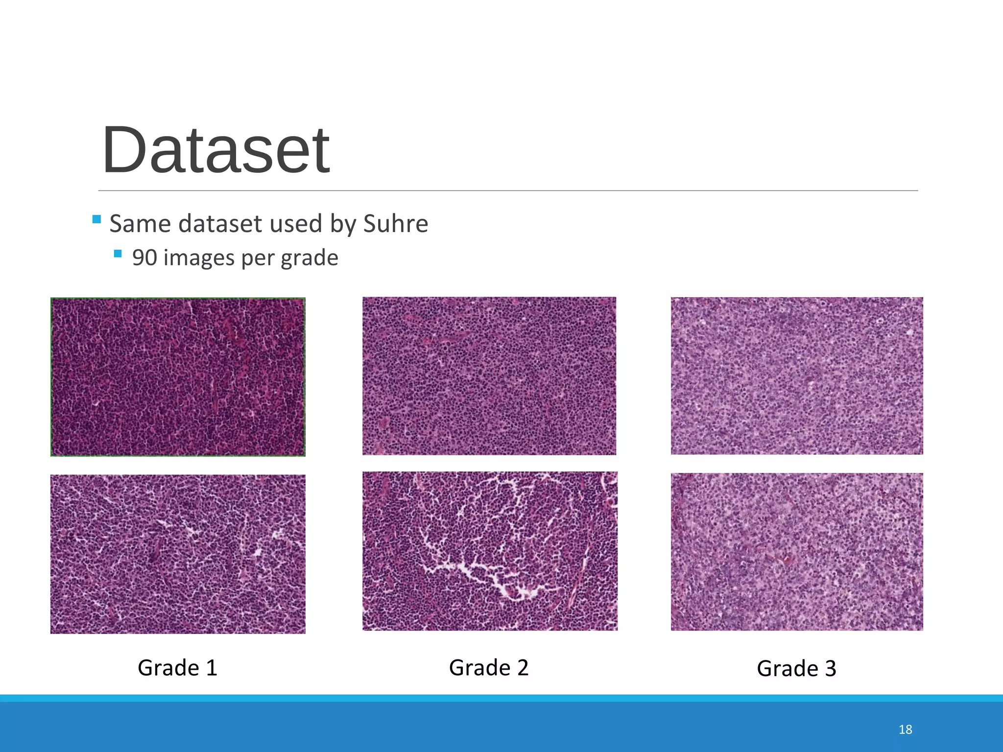 Multi Scale Directional Filtering Based Method For Follicular Lymphoma Grading Ppt