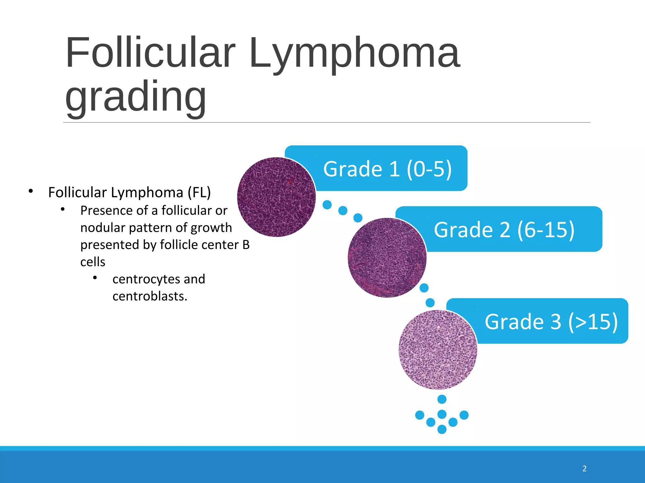 Multi Scale Directional Filtering Based Method for Follicular Lymphoma ...