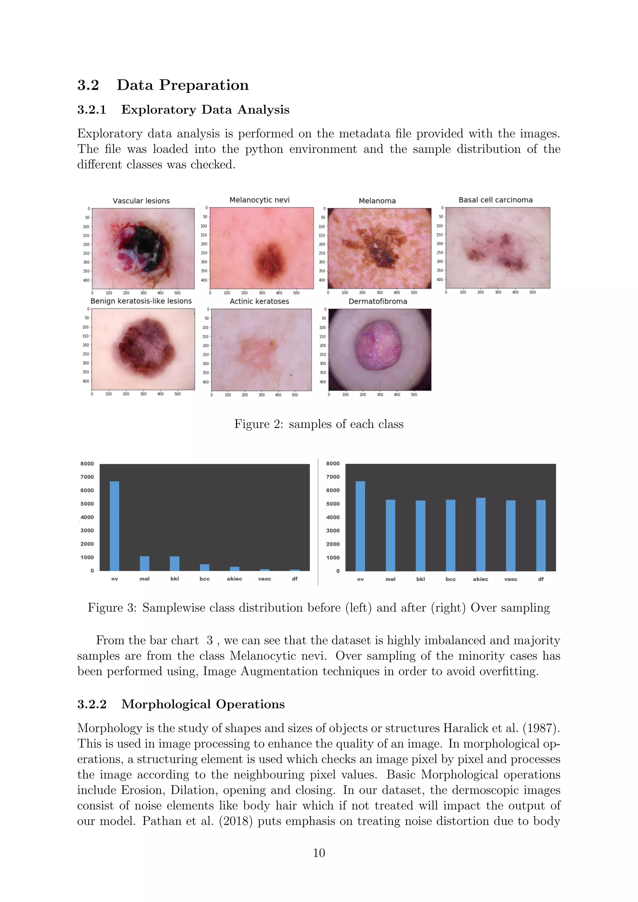 Multiclass skin lesion classification with CNN and Transfer Learning | PDF