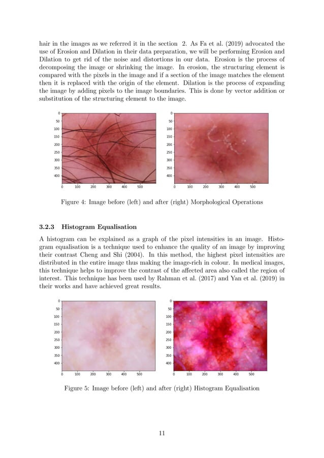 Multiclass skin lesion classification with CNN and Transfer Learning | PDF