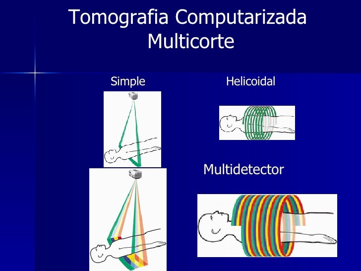 Multicorte Ortopedia
