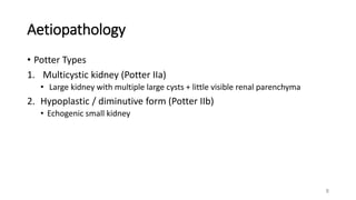 Multicystic Dysplastic Kidney.pptx