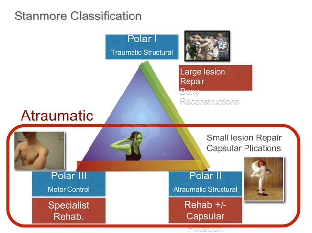 Multidirectional instability of the shoulder 2014 | PPT
