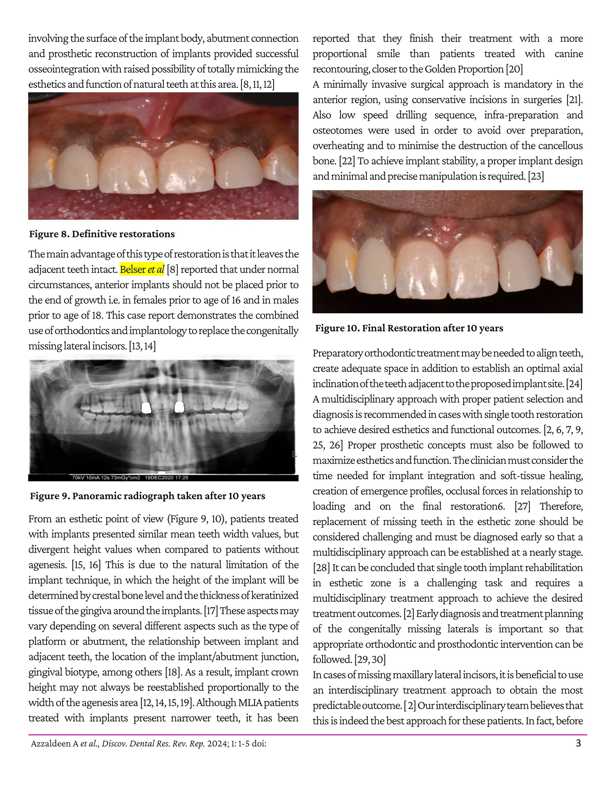 Multidisciplinary Approach for Management of Congenitally Missing.pdf