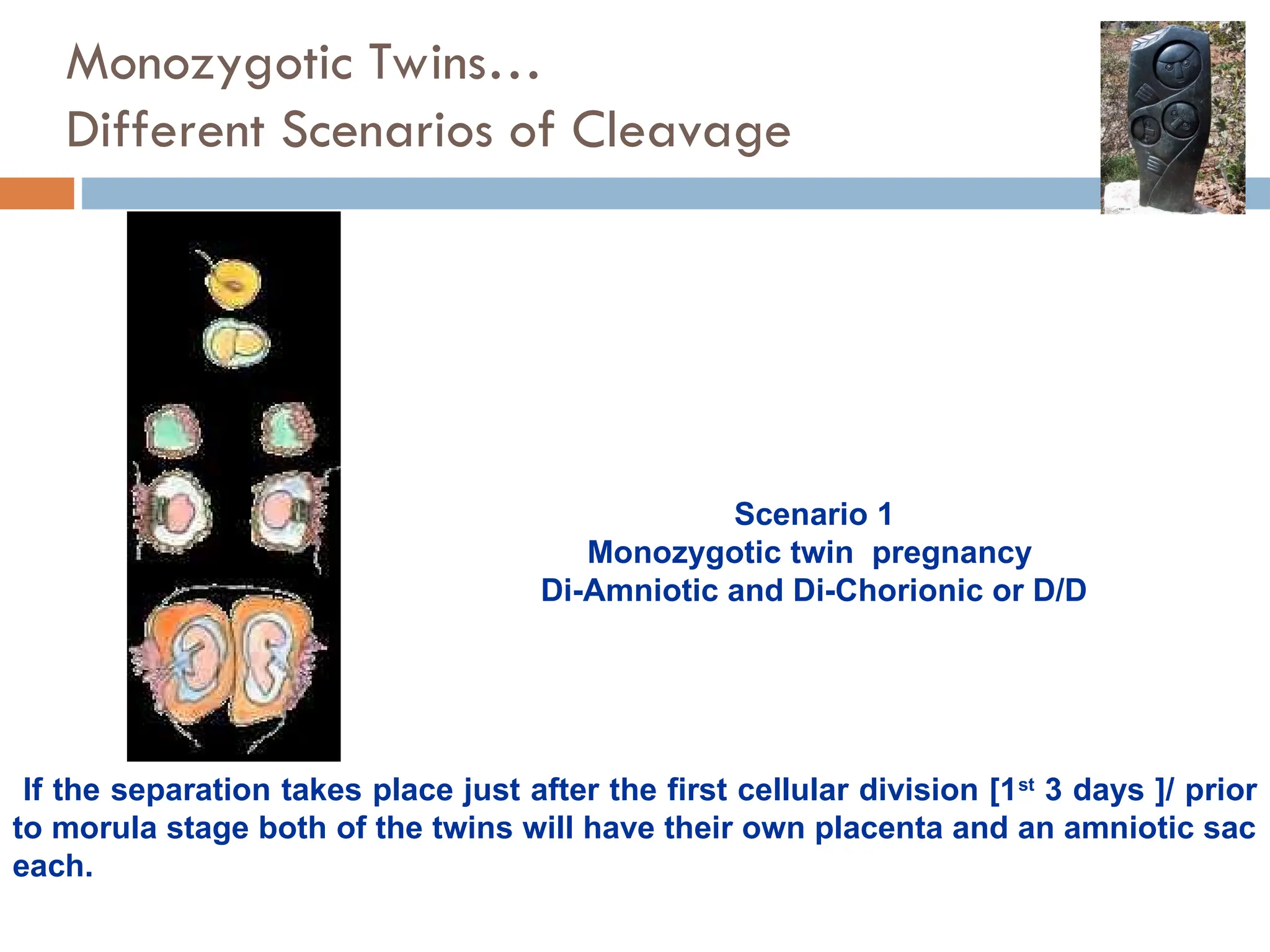 multifetal-pregnancy in mothers for bsc 4 year | PPT