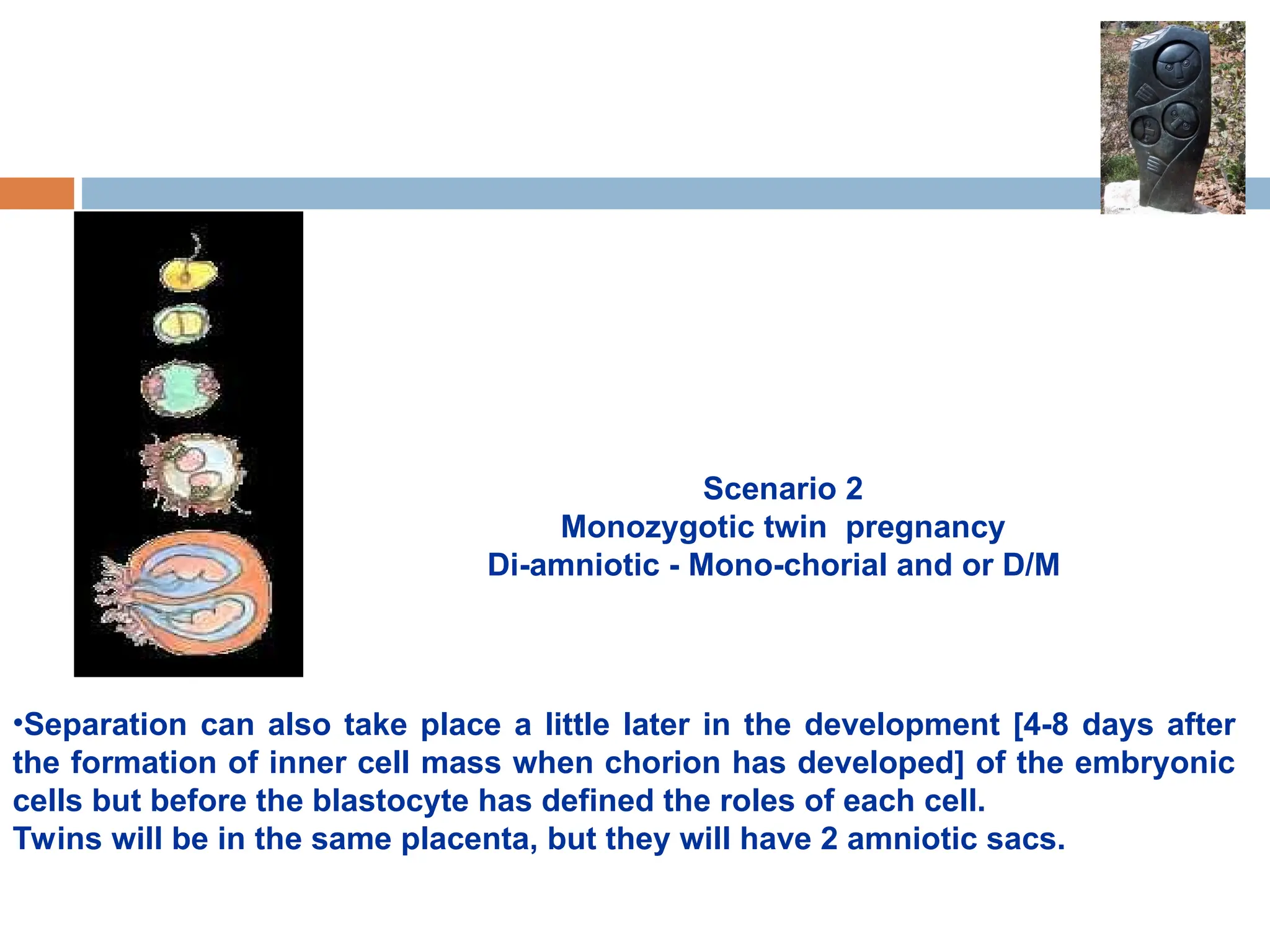 multifetal-pregnancy in mothers for bsc 4 year | PPT