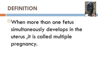 multifetal-pregnancy in mothers for bsc 4 year | PPT