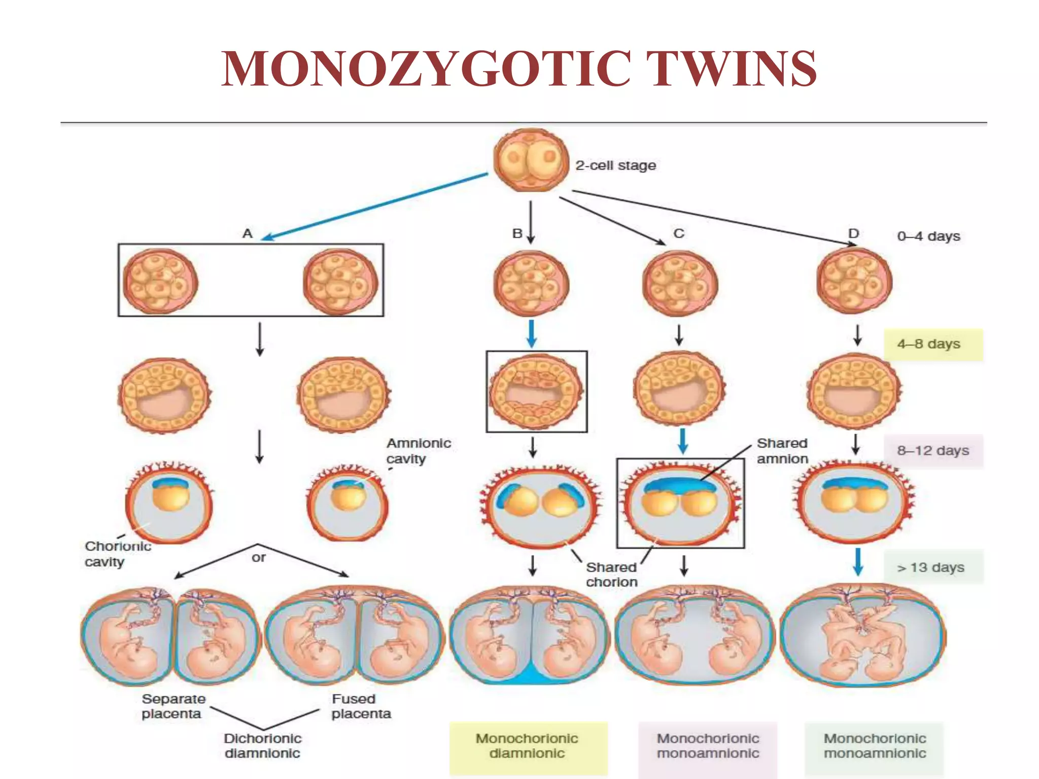 Multifetal gestation | PPTX