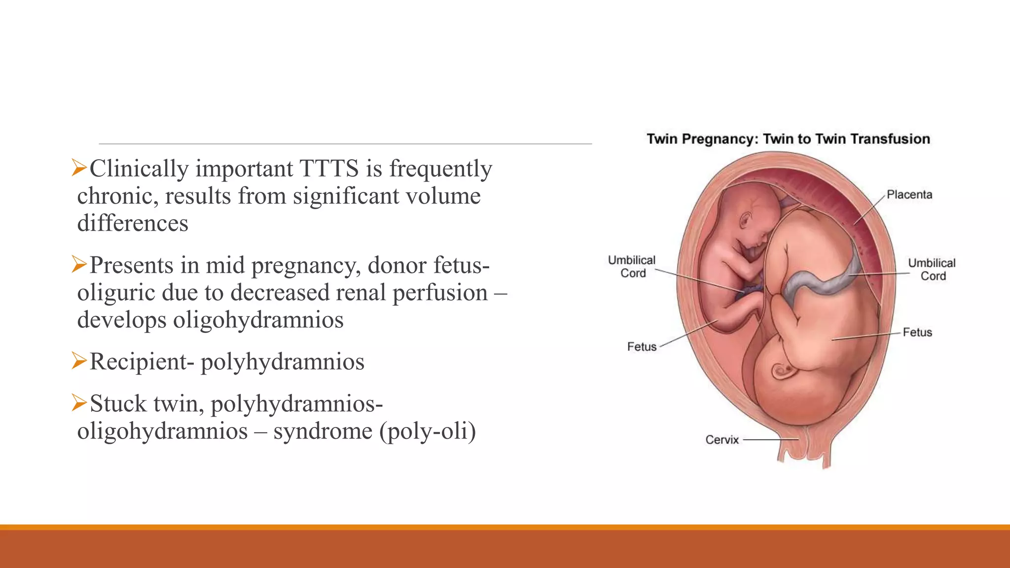 Multifetal pregnancy (Twins Pregnancy) | PPTX