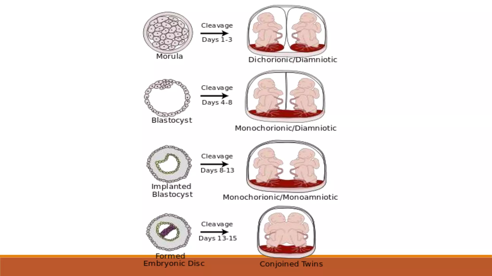 Multifetal pregnancy (Twins Pregnancy) | PPTX