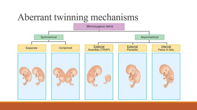 Multifetal pregnancy (Twins Pregnancy) | PPTX