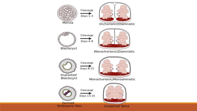 Multifetal pregnancy (Twins Pregnancy) | PPTX