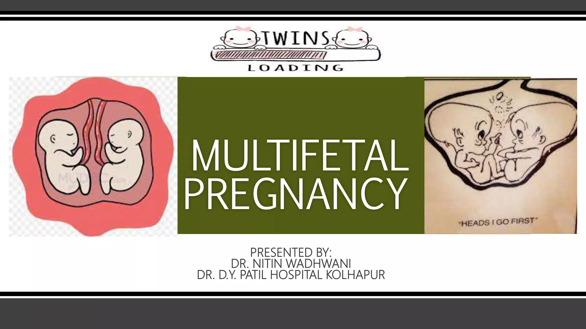 Multifetal pregnancy RADIOLOGY | PPTX