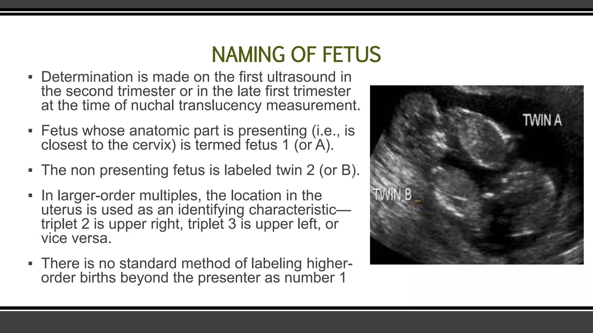 Multifetal pregnancy RADIOLOGY | PPTX