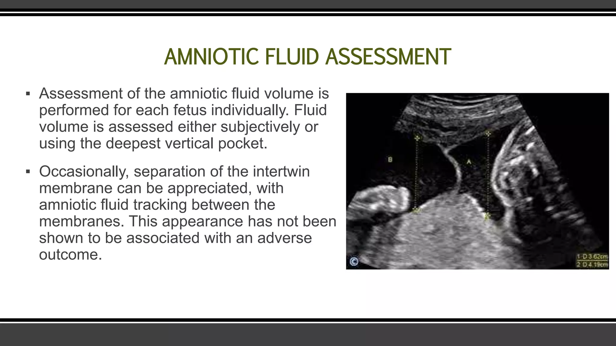 Multifetal pregnancy RADIOLOGY | PPTX