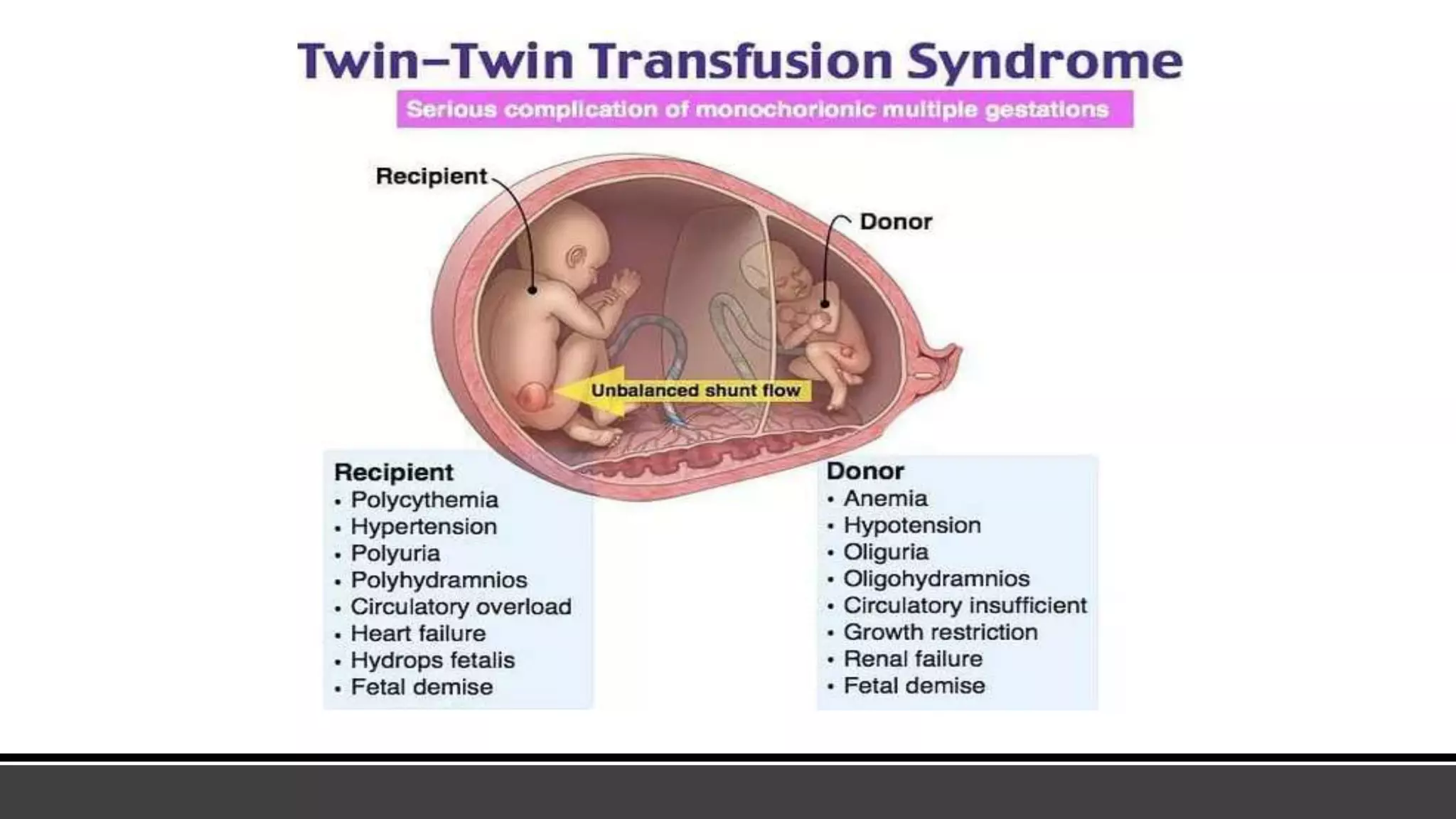 Multifetal pregnancy RADIOLOGY | PPTX