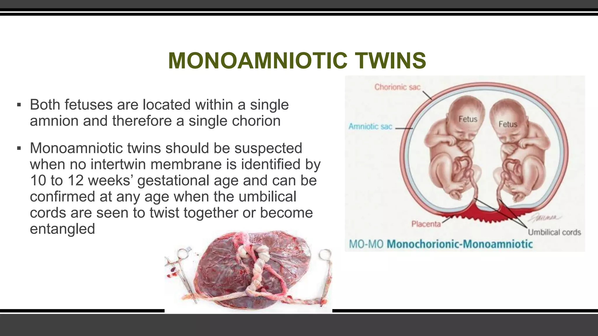 Multifetal pregnancy RADIOLOGY | PPTX