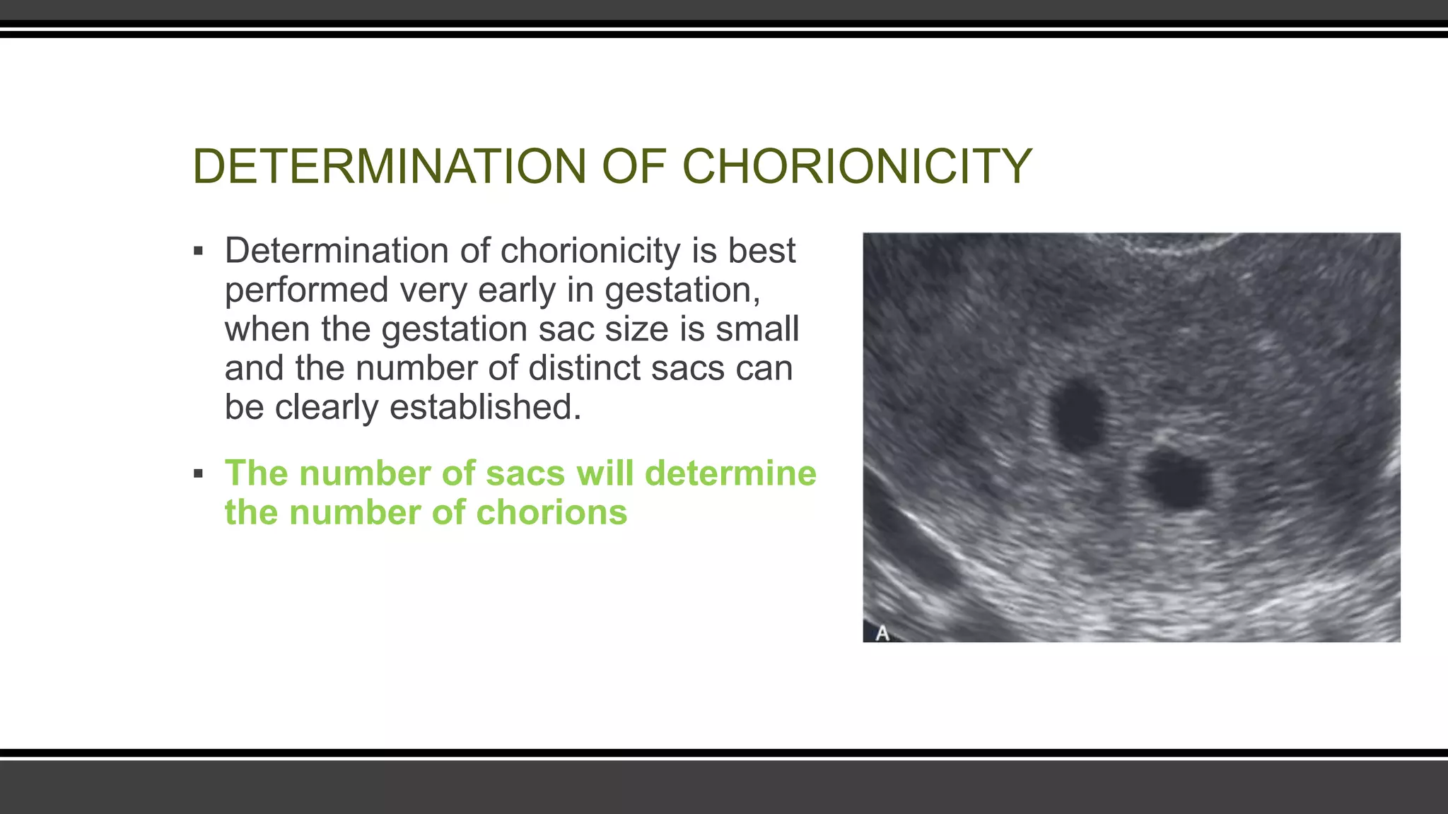 Multifetal pregnancy RADIOLOGY | PPTX