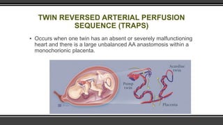 Multifetal pregnancy RADIOLOGY | PPTX